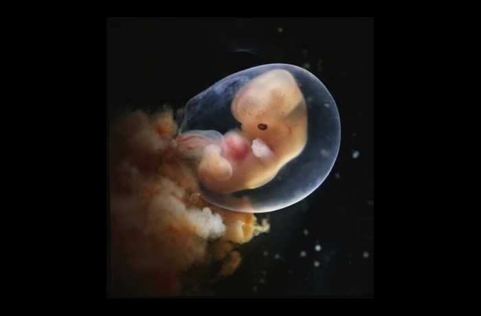 Facts And PIctures On Abortion At 4 Or 5 Weeks ClinicQuotes