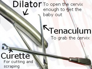 Pictures of the Tools Used to Perform Abortions - ClinicQuotes